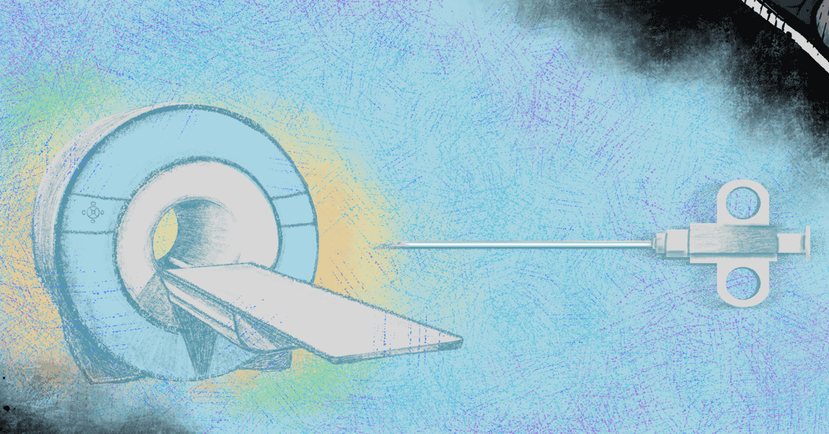 What is a Prostate Biopsy Like? Here's My Experience